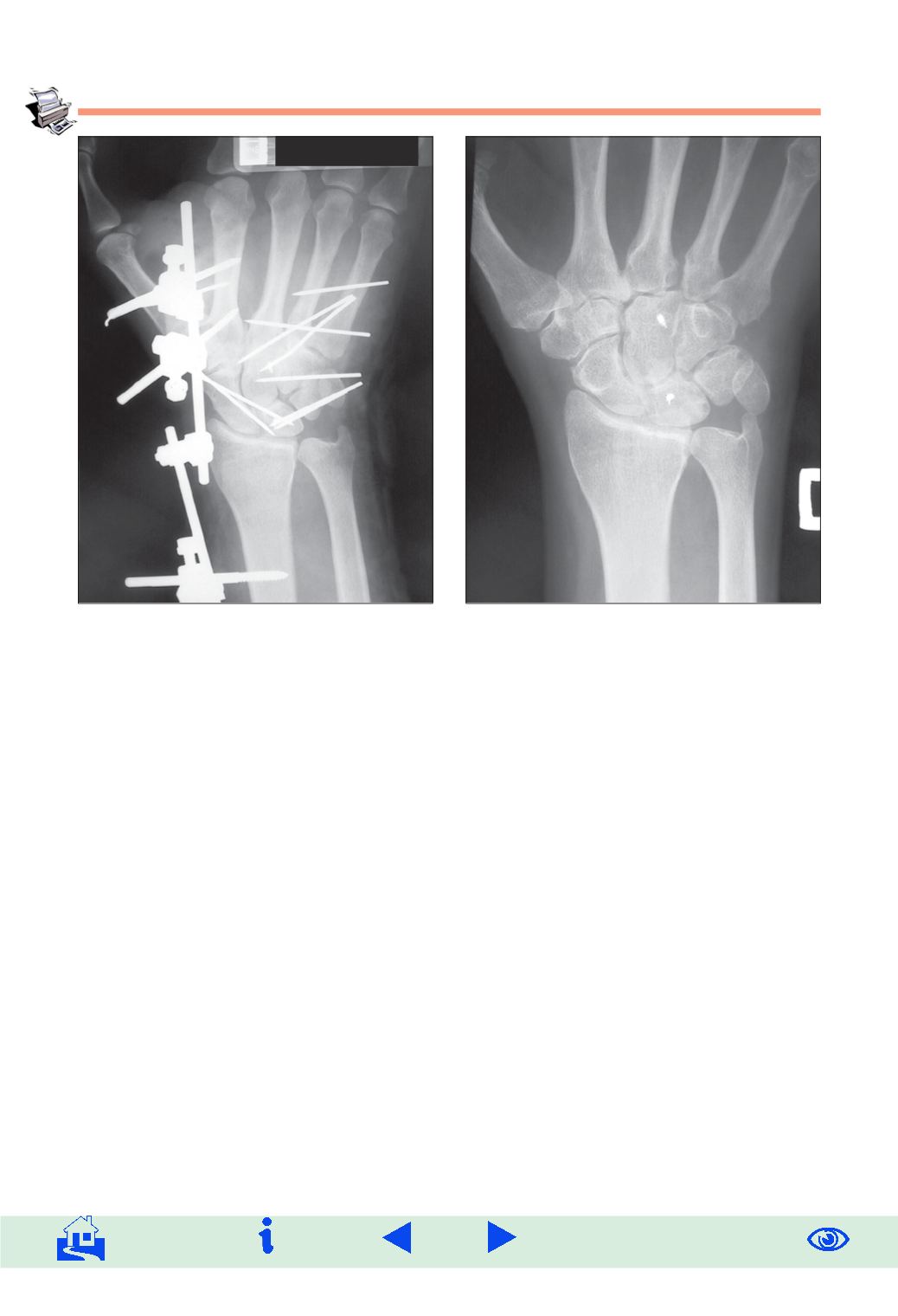 Volumen 45 Número 1 – SCHOT